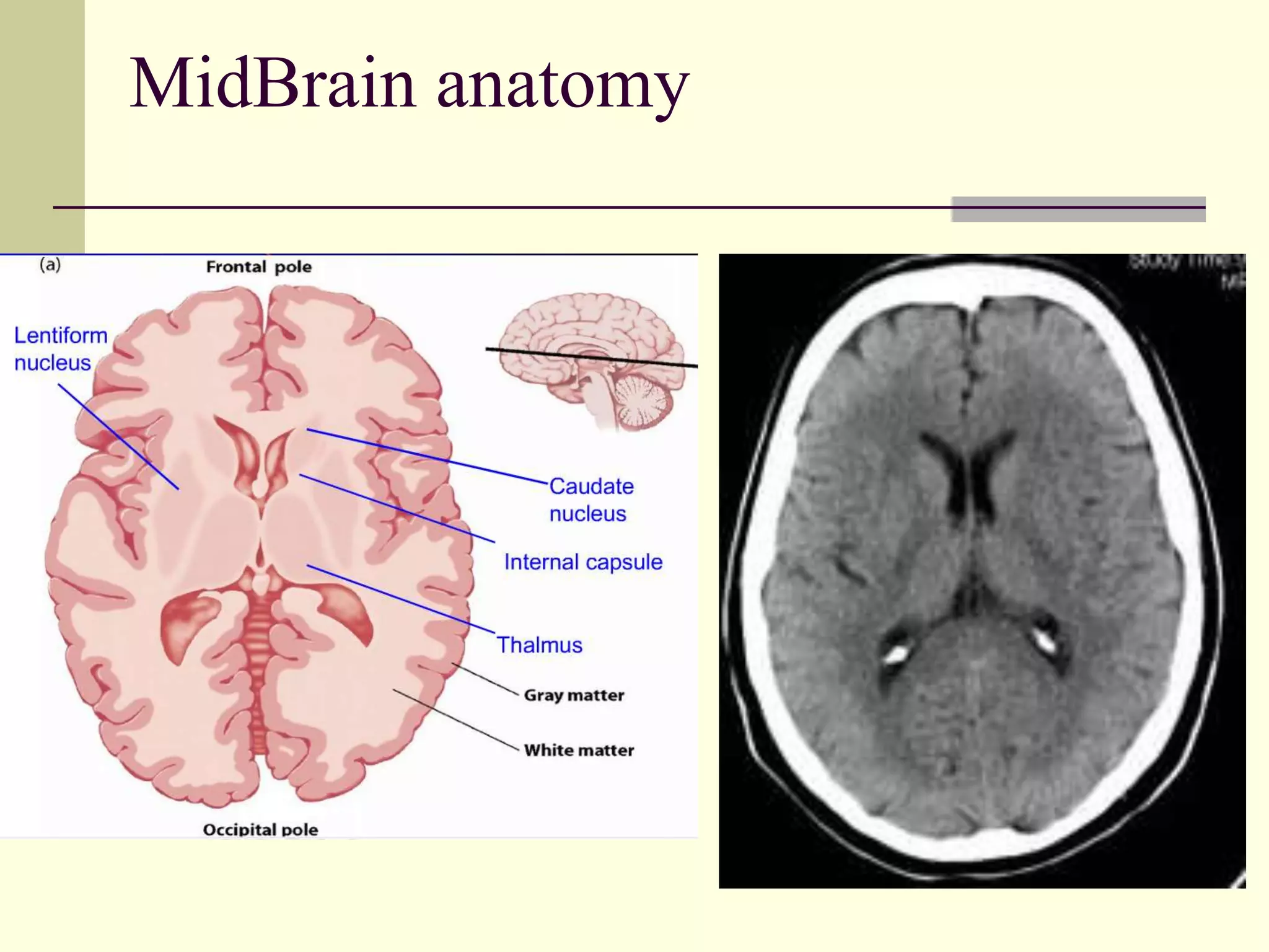 (R)brain ct anatomy (1) | PPT