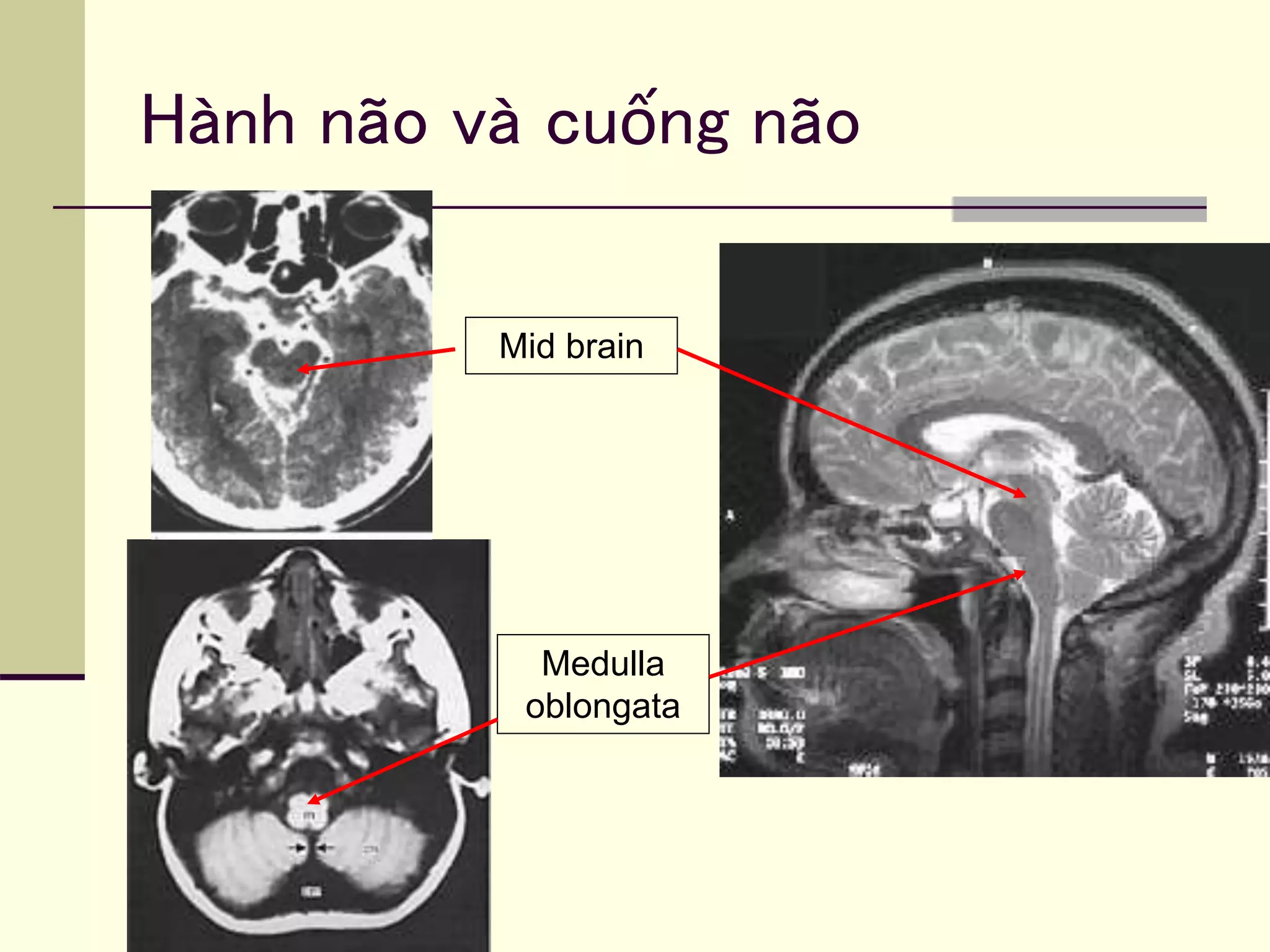 (R)brain ct anatomy (1) | PPT