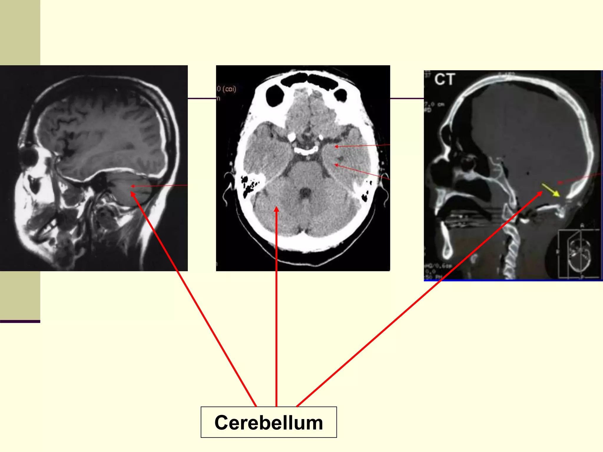(R)brain ct anatomy (1) | PPT