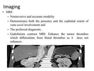 RCC- Staging and treatment of Renal Cell Carcinoma | PPTX