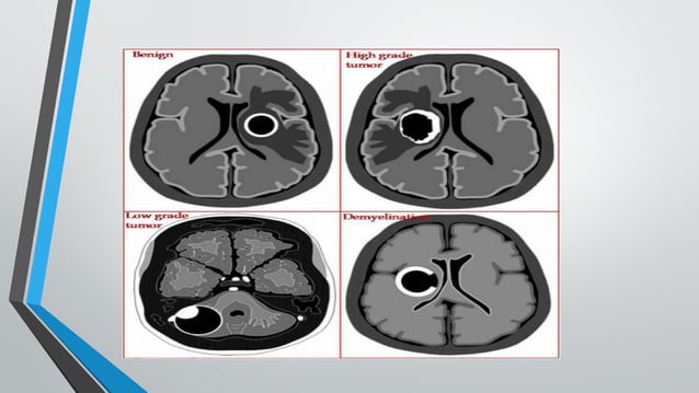 rcc.pptxb JJ kall ohh hmm gg seeker of the number q | PPT