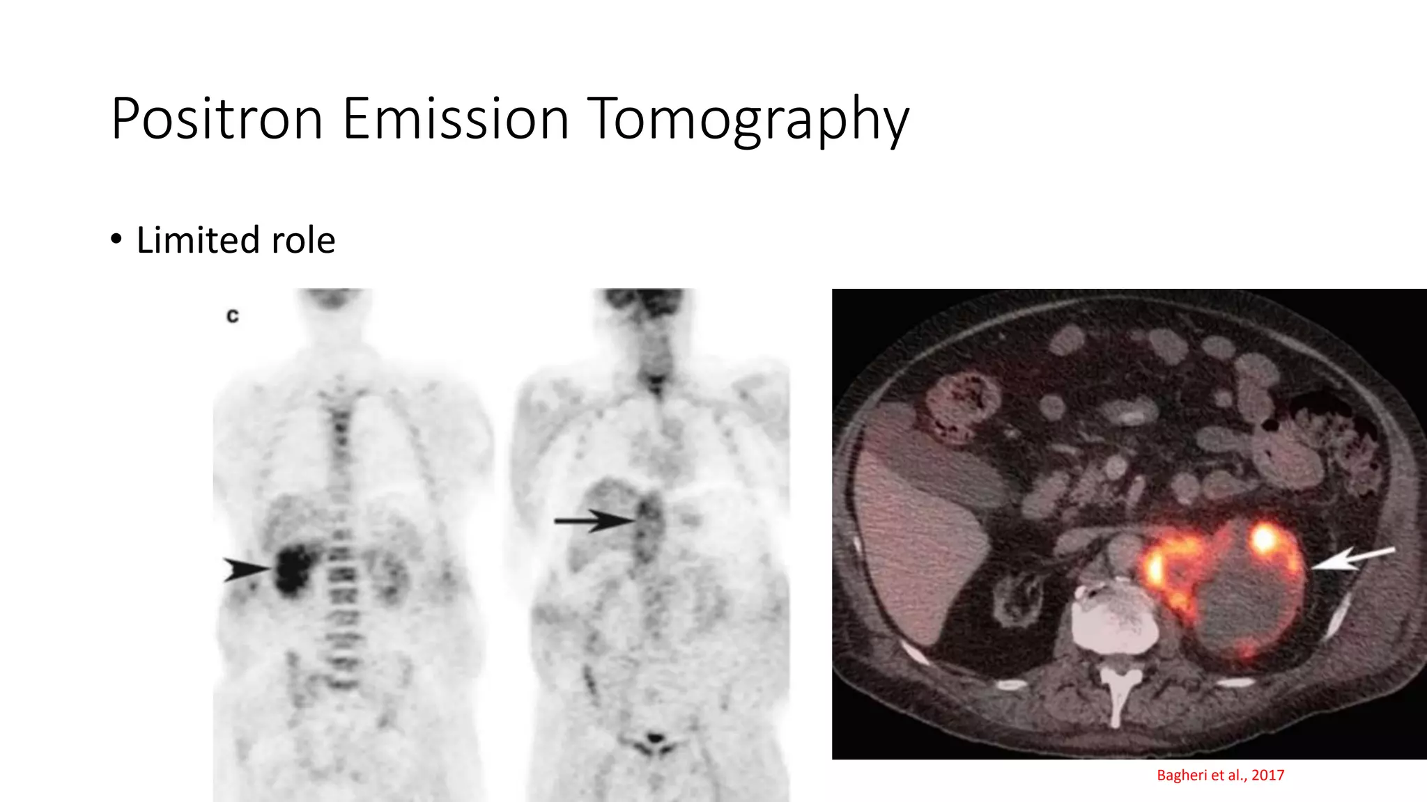 imaging in RCC | PPTX