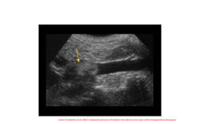 imaging in RCC | PPTX