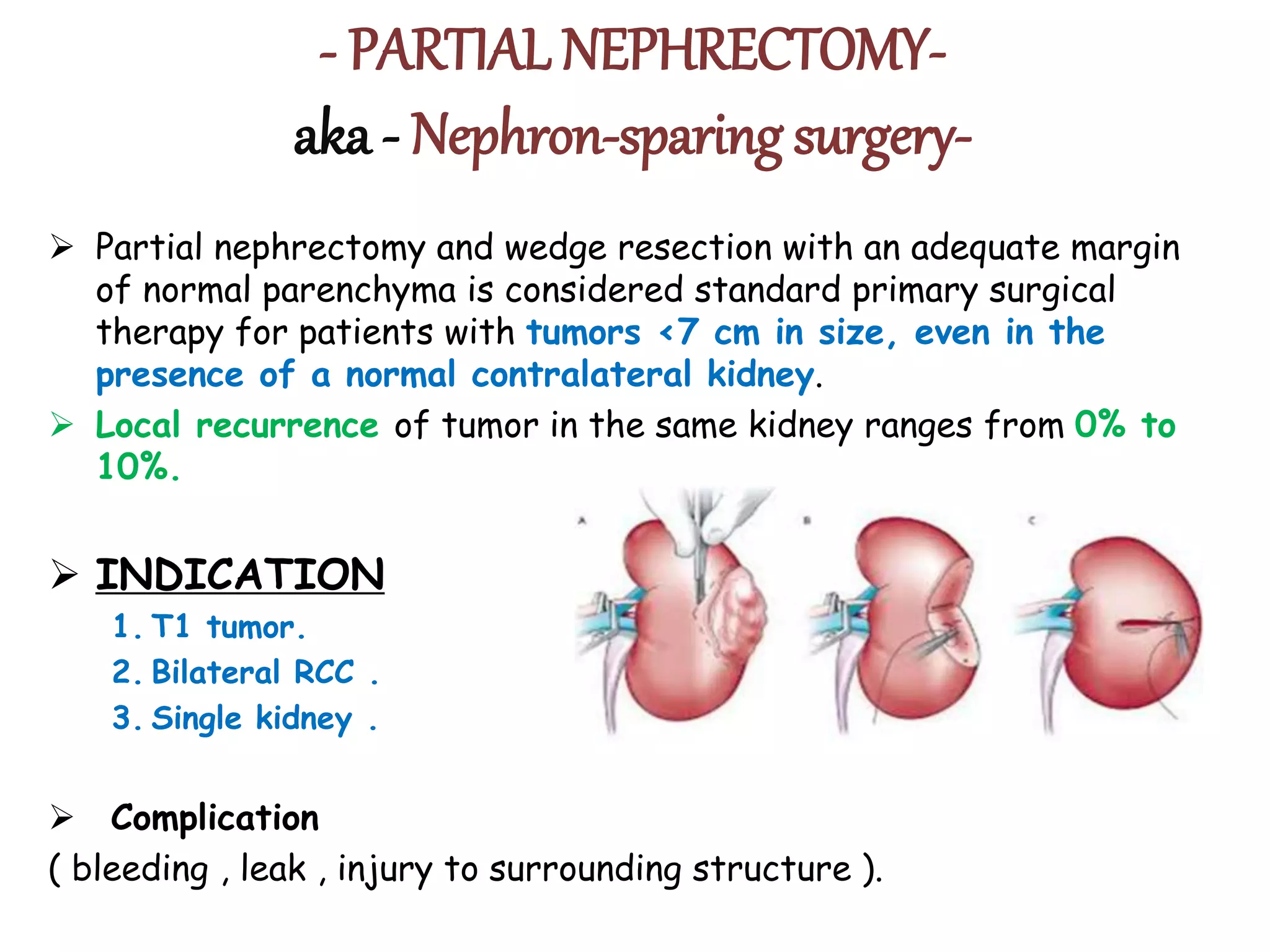 Rcc and bladder cancer | PPT
