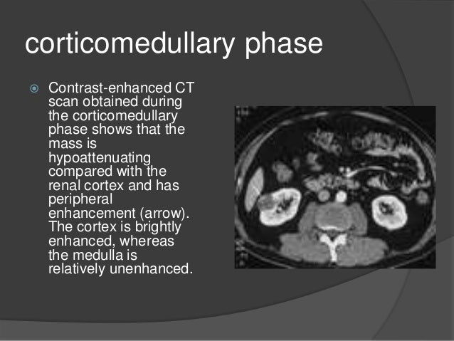 renal cell carcinoma radiology