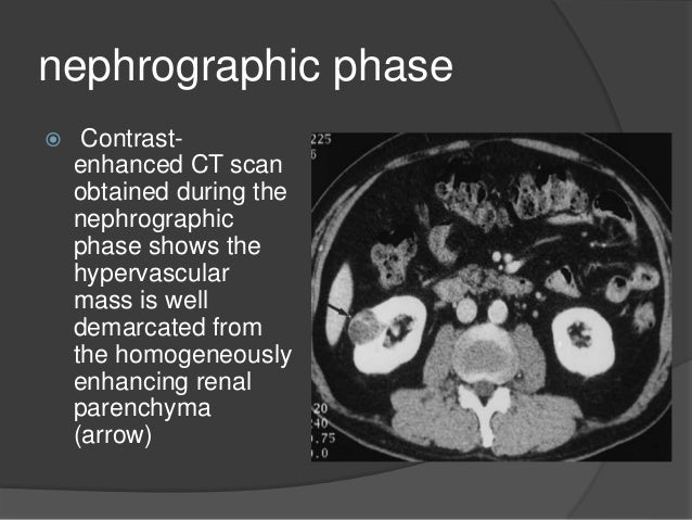renal cell carcinoma radiology