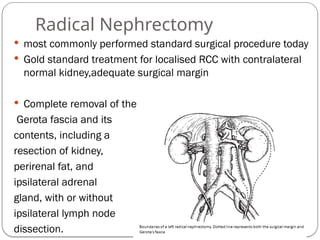 RCC pk.pptx. . | PPT