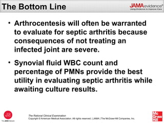 Septic Arthritis and Osteomyelitis in Children.ppt