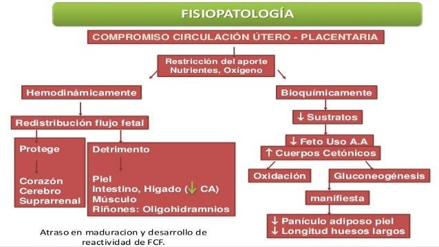 Restriccion del crecimiento Intrauterino (RCIU)