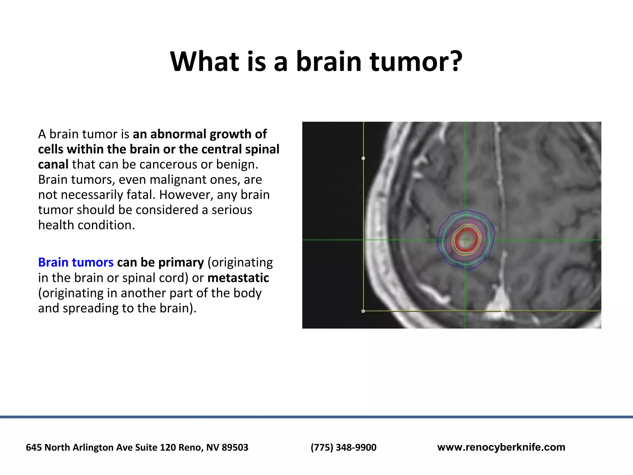 Brain Tumors: Reno CyberKnife Treatment Overview | PPT