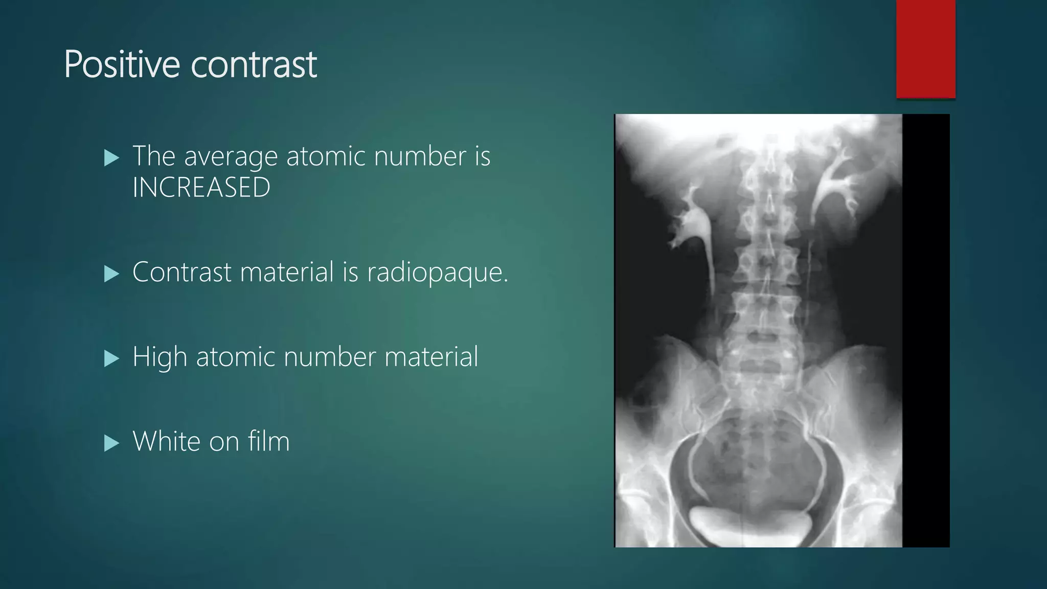 Radiographic contrast media (urology) | PPTX