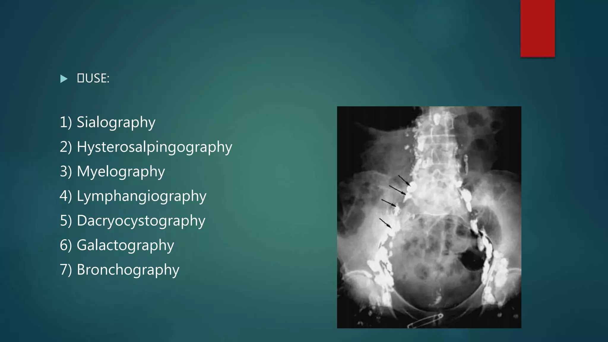 Radiographic contrast media (urology) | PPTX