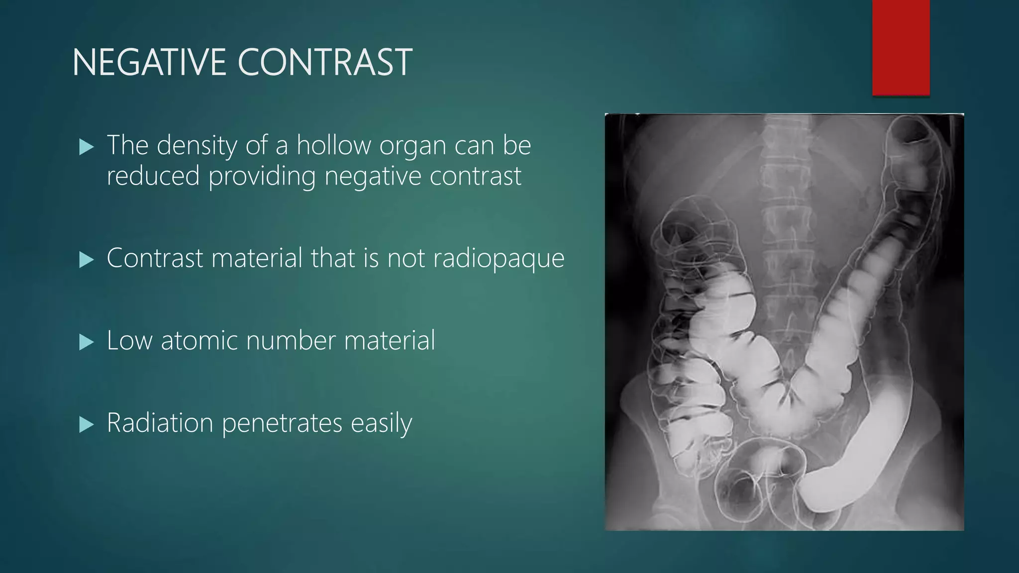 Radiographic contrast media (urology) | PPTX