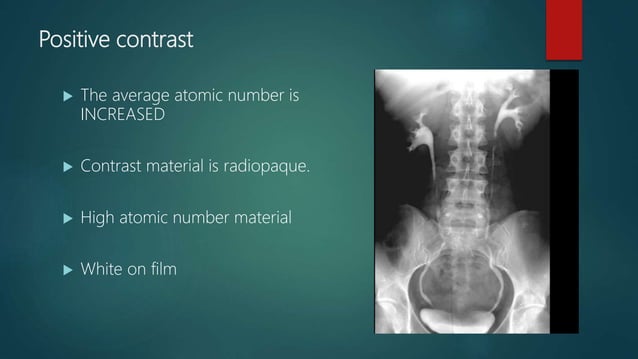 Radiographic contrast media (urology) | PPTX