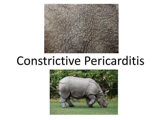 Echo Differentiation of Restrictive Cardiomyopathy and Constrictive ...