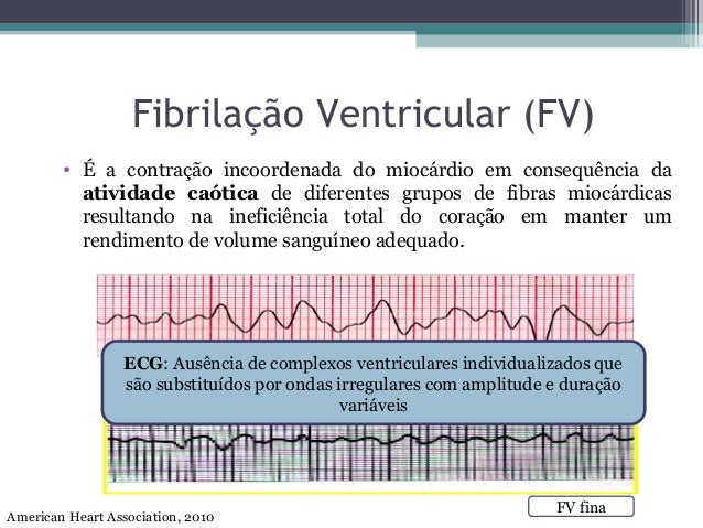Ressuscitação Cardiopulmonar