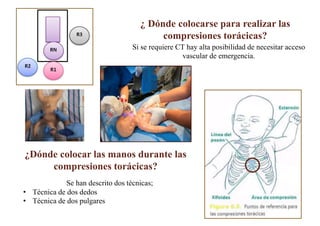 reanimación cardiopulmonar neonatal | PPTX