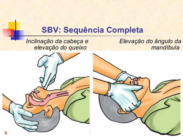 RCP - Suporte Básico de Vida (2014)