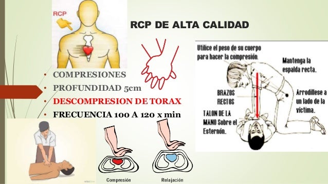 RCP BASICO