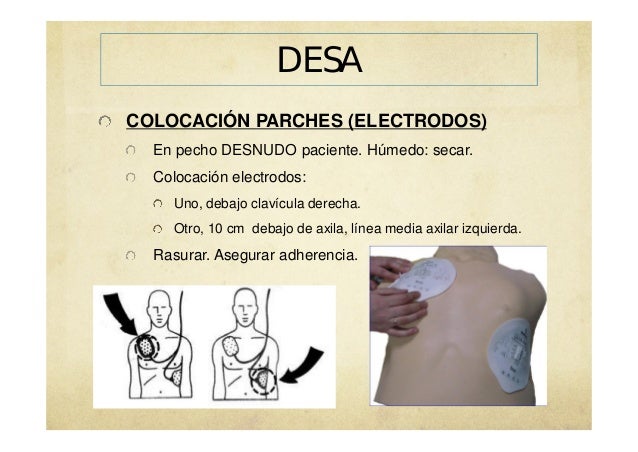 Rcp básica y desa csi segorbe