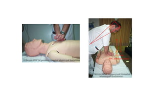 Rcp completo | PPTX