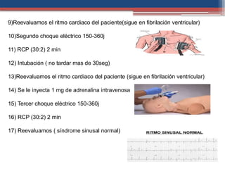 RCP Avanzado | PPTX