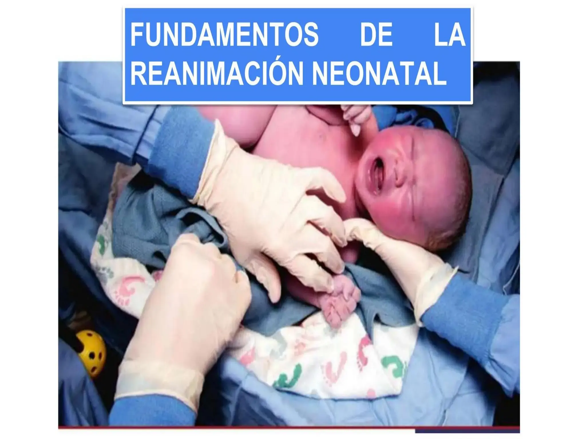 RCP NEO.pptx rcp neonatal reanimacion cradiopulmonar | PPTX