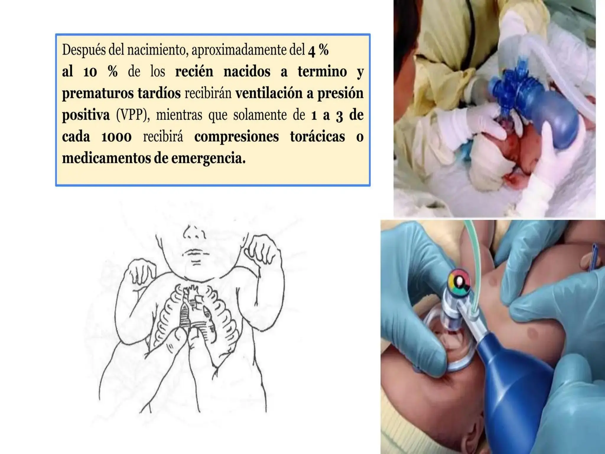 RCP NEO.pptx rcp neonatal reanimacion cradiopulmonar | PPTX