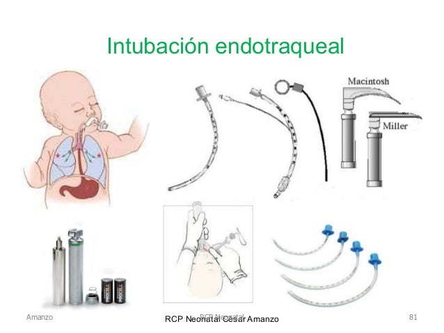 RCP Neonatal