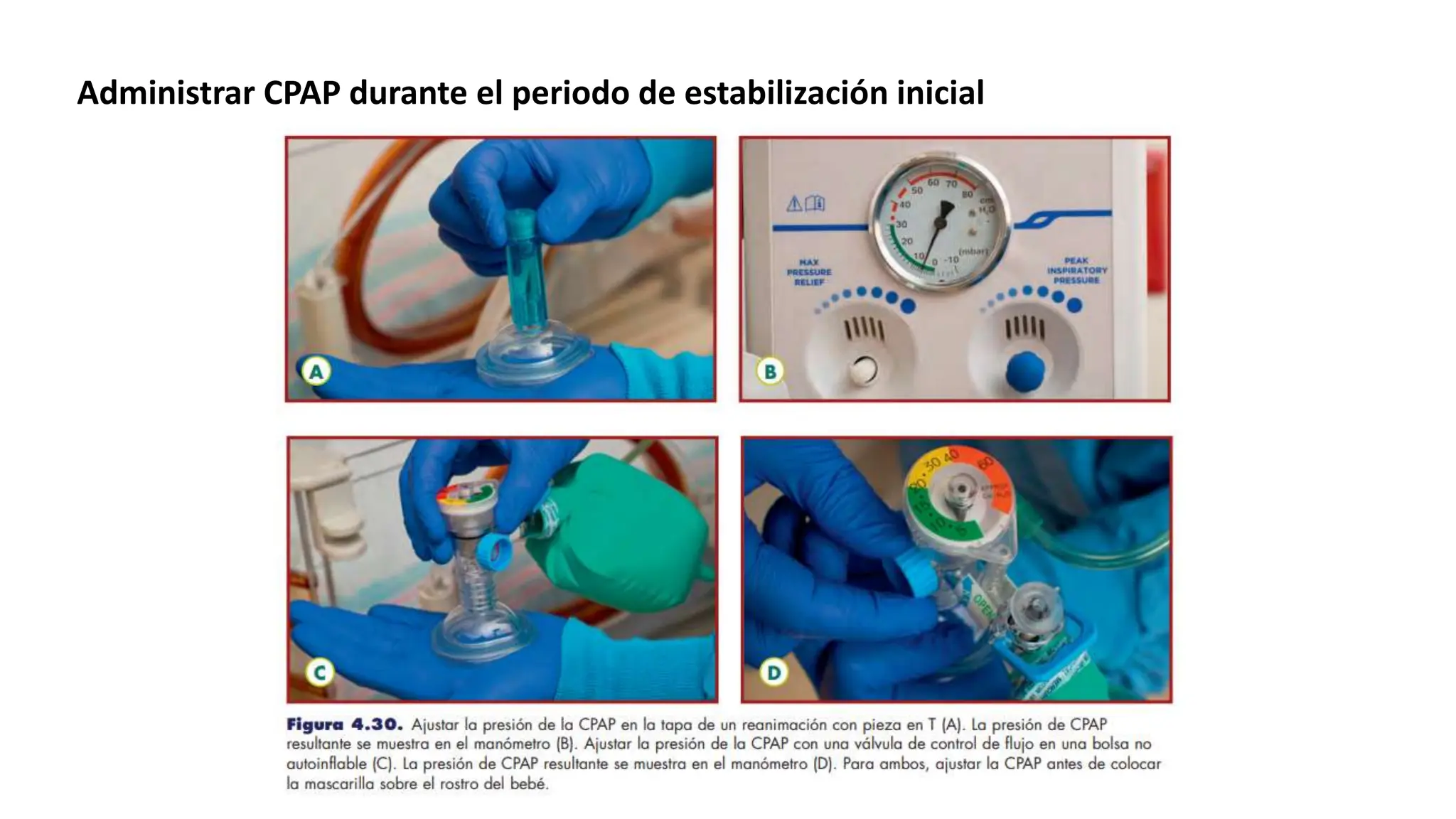 TECNICA DE RCP EN NEONATOS Y EN RNPT .pptx | First Aid | Injuries