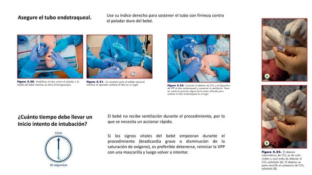 TECNICA DE RCP EN NEONATOS Y EN RNPT .pptx