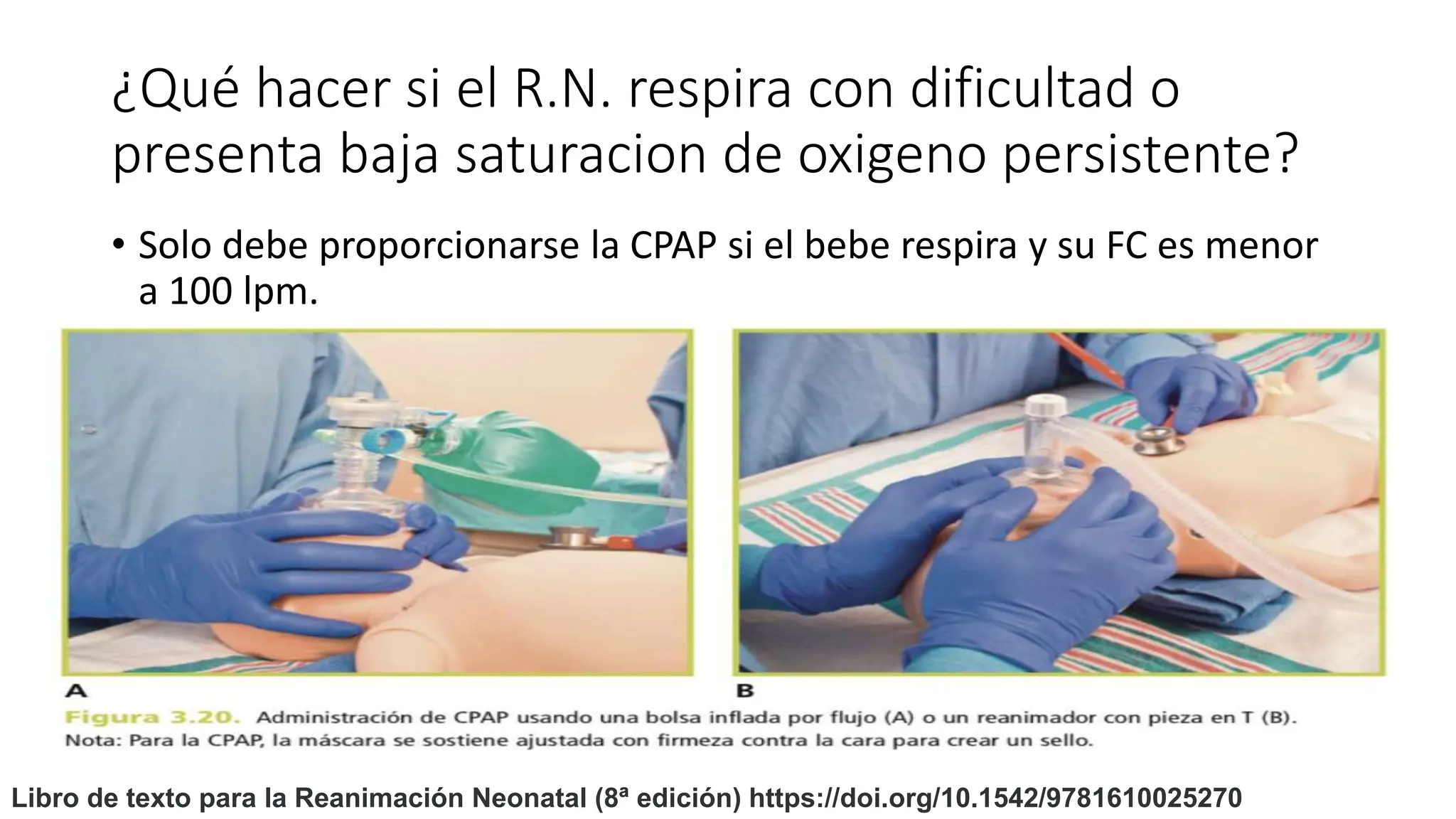 RCP neonatal y pediatrico.pptx