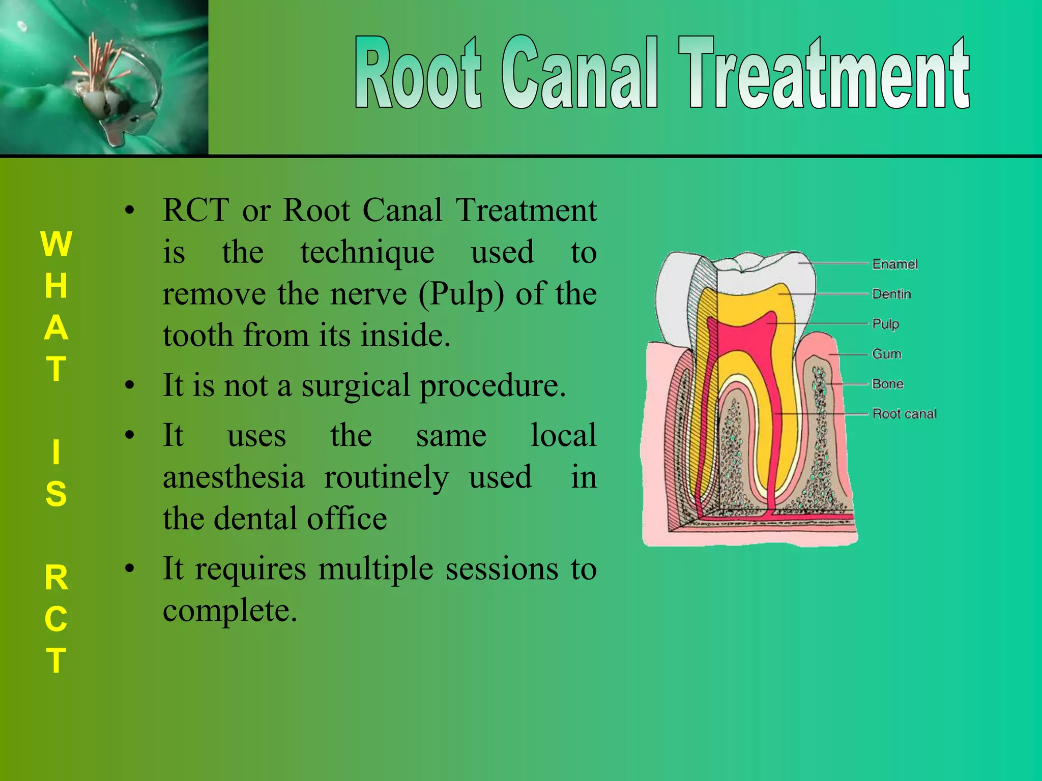 RCT | PPT