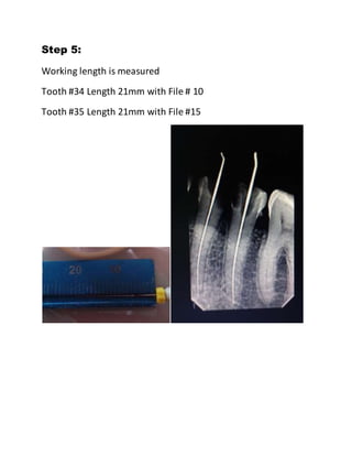 RCT by Dr.Natasha Aziz | PDF