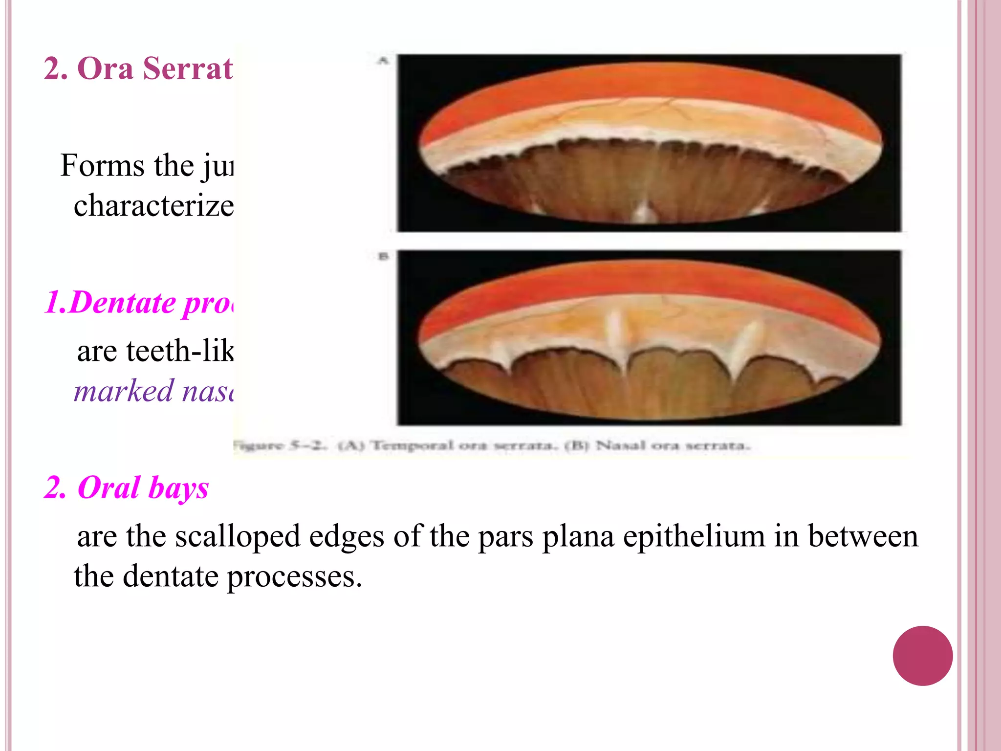 RETINAL DETACHMENT | PPTX
