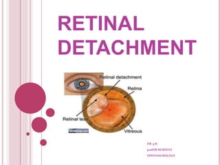 RETINAL DETACHMENT | PPTX