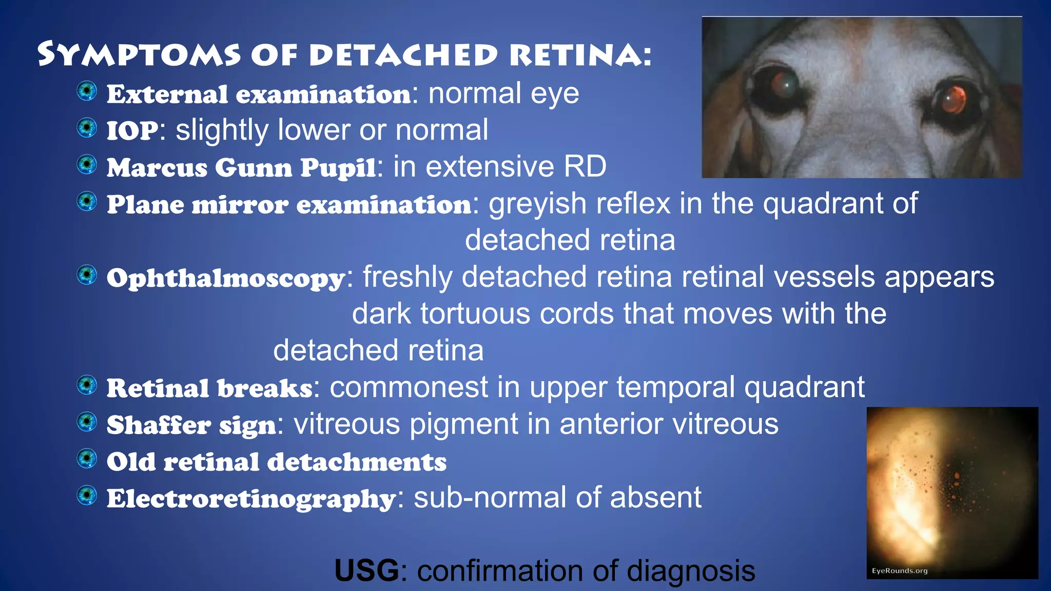 Retinal Detachment | Ophthalmology | PPT