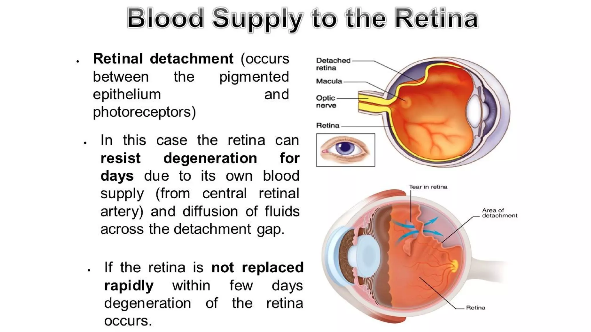 Retinal Detachment | Ophthalmology | PPT