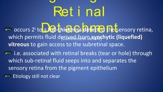 Retinal Detachment | Ophthalmology | PPT