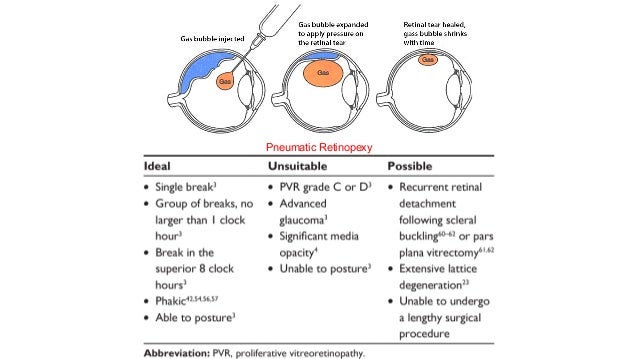 Retinal Detachment | Ophthalmology