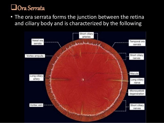 Retinal detachment