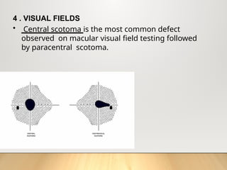 Comprehensive Overview of Retinal Diseases and Dry Eye Syndrome | PPTX