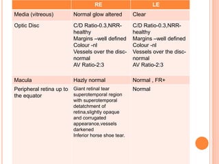 Retinal ditachment case discussion | PPTX