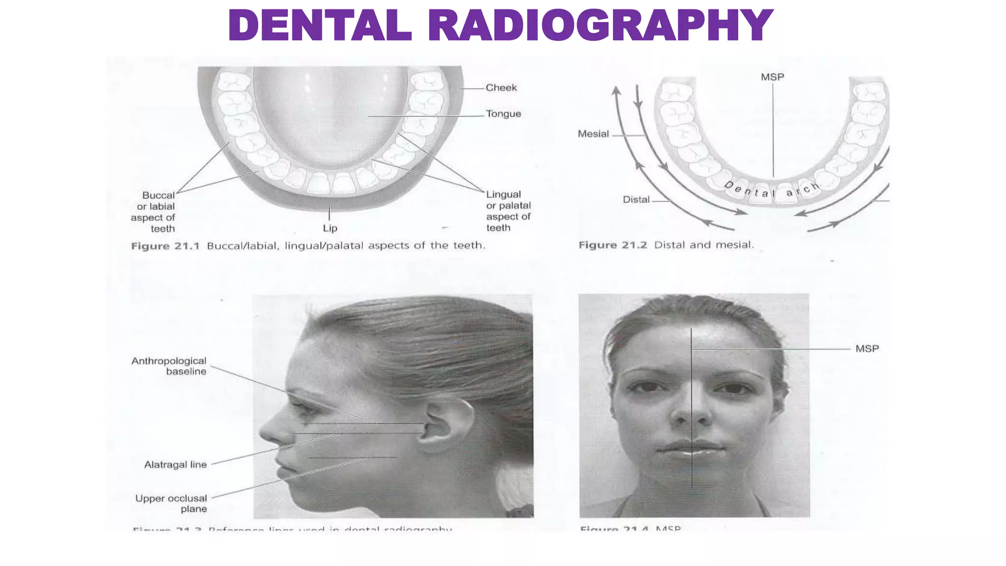 Dental radiography | PPTX