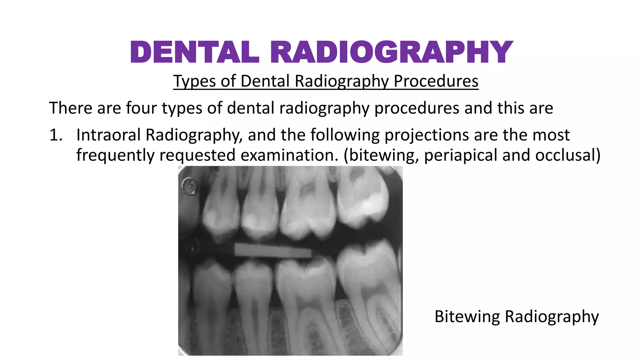 Dental radiography | PPTX | Dental Health | Diseases and Conditions