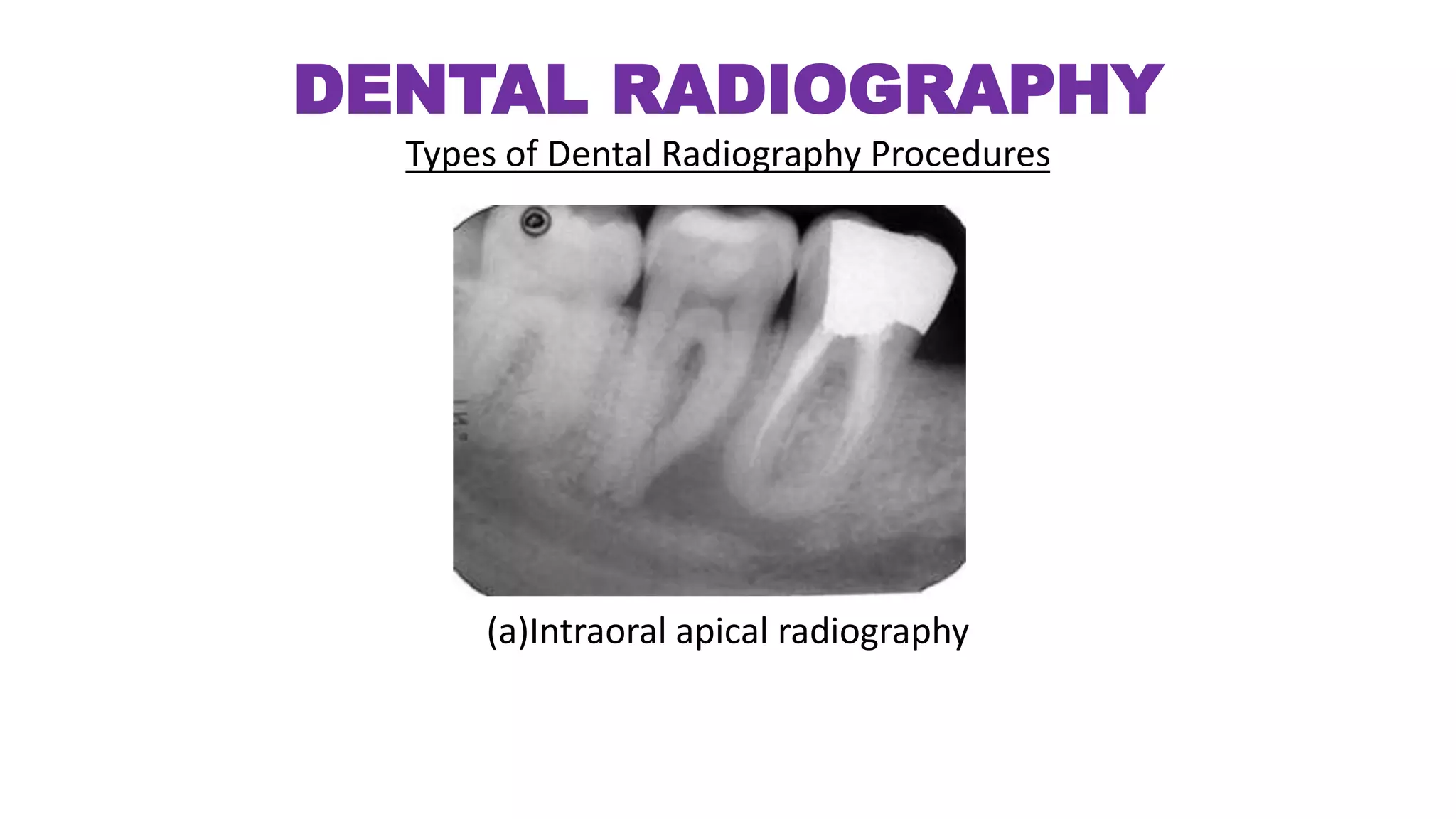 Dental radiography | PPTX