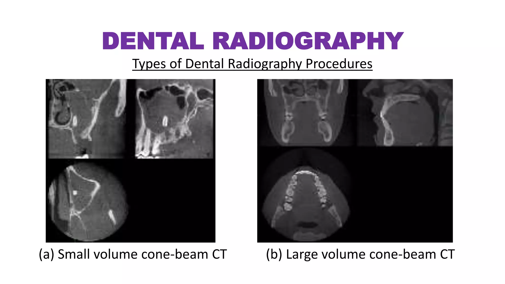 Dental radiography | PPTX
