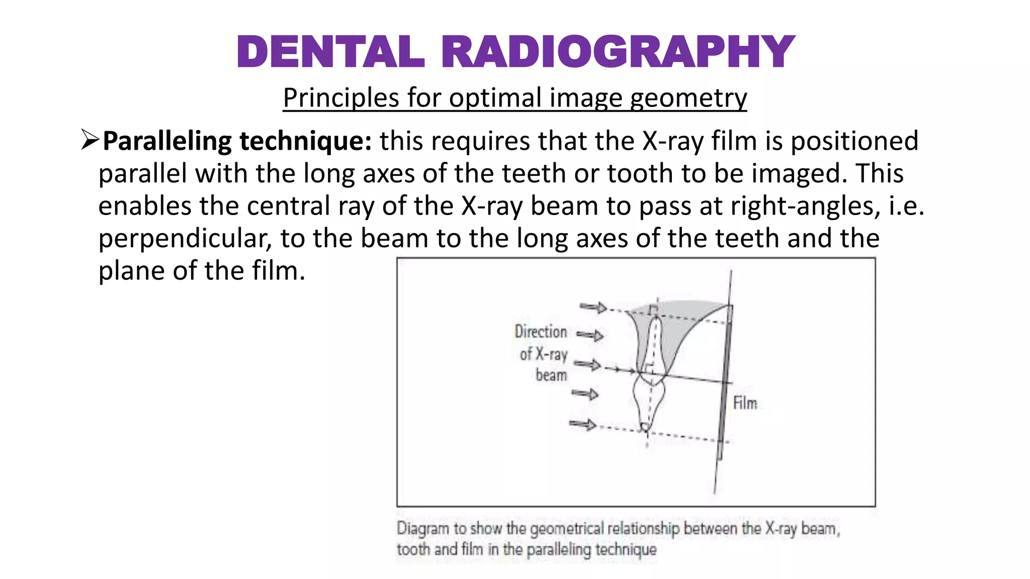 Dental radiography | PPTX
