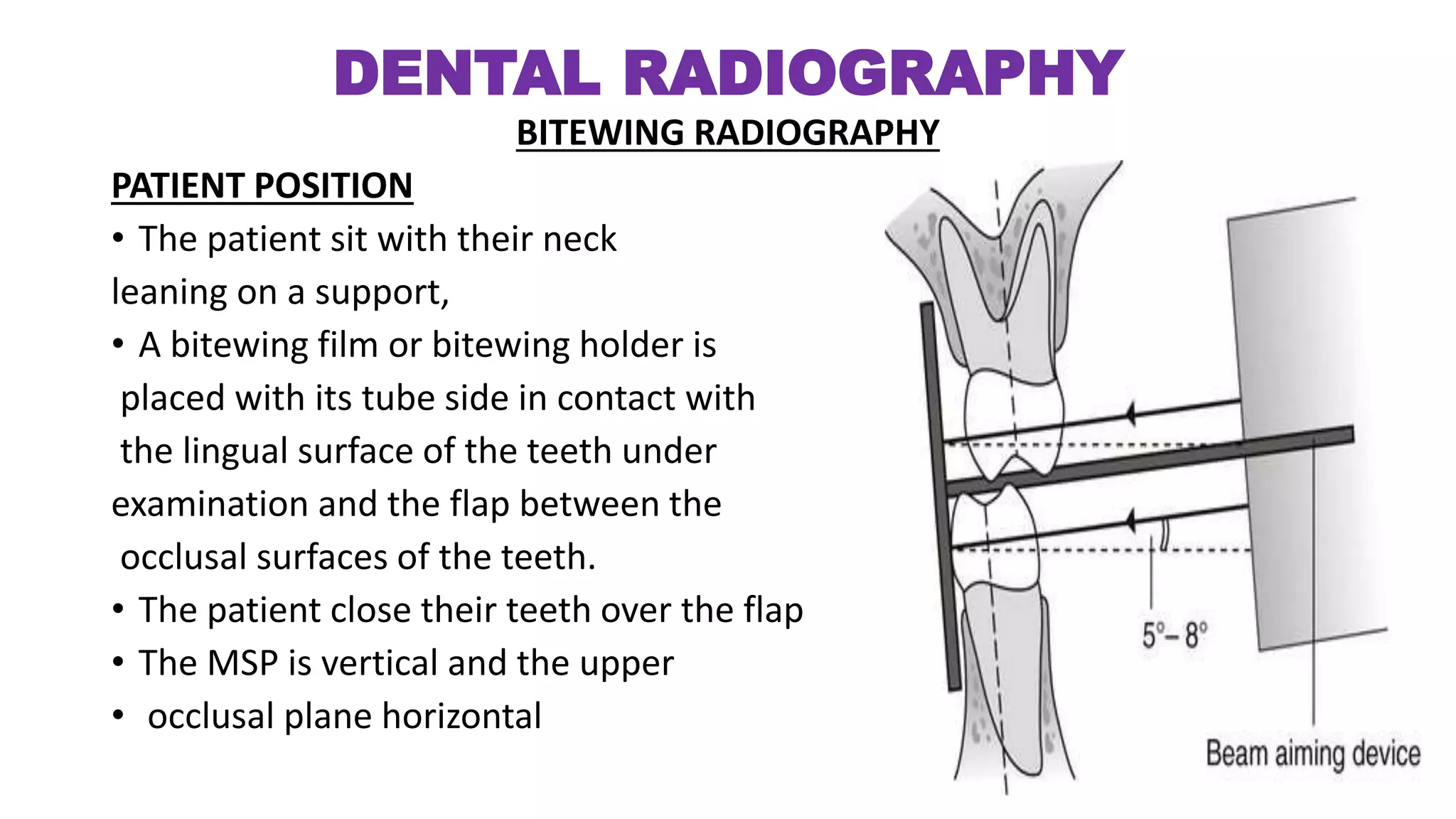 Dental radiography | PPTX | Dental Health | Diseases and Conditions
