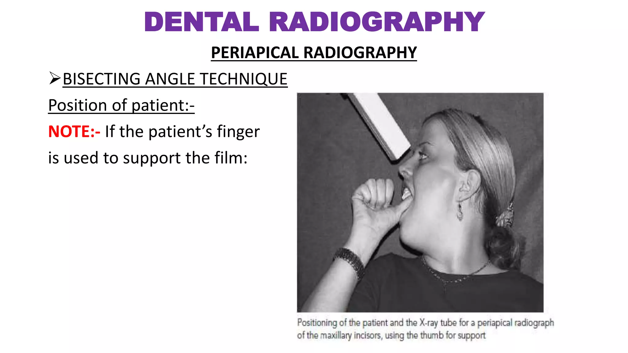 Dental radiography | PPTX